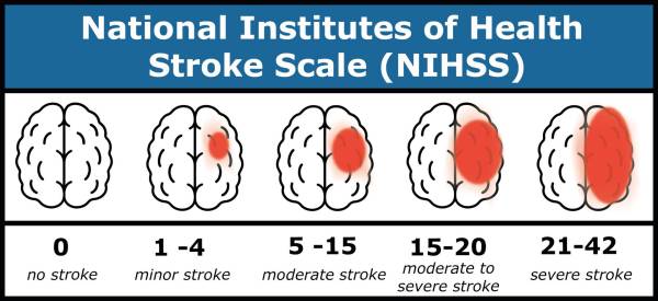 Interventional Radiology - The Stroke Patient